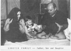 The Infamous Life and Death of Grady' The Lobster Boy' Stiles Jr.